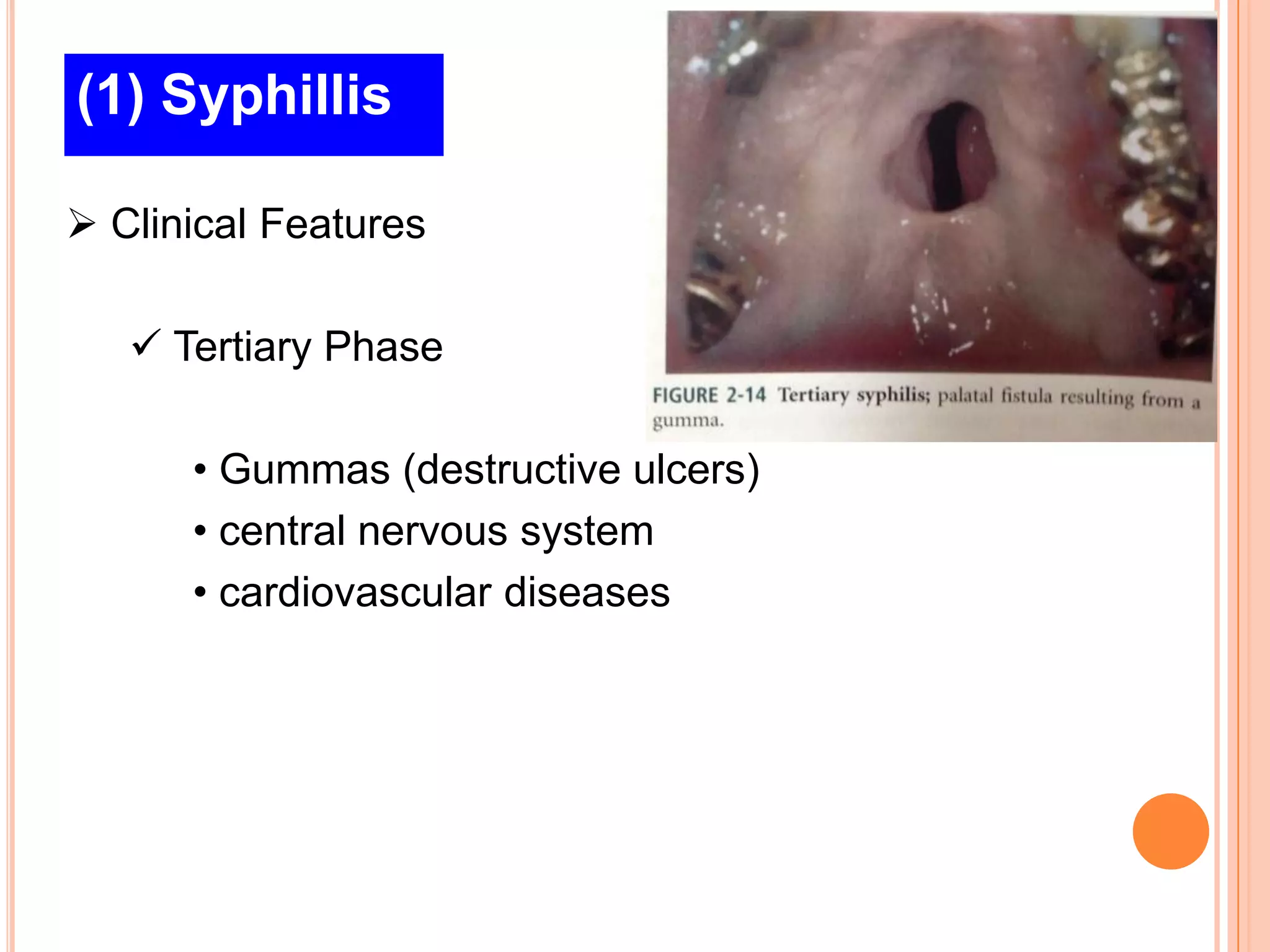 Bacterial infections (4) | PPTX