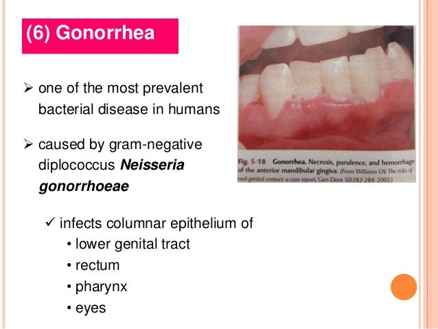 Bacterial infections (4)