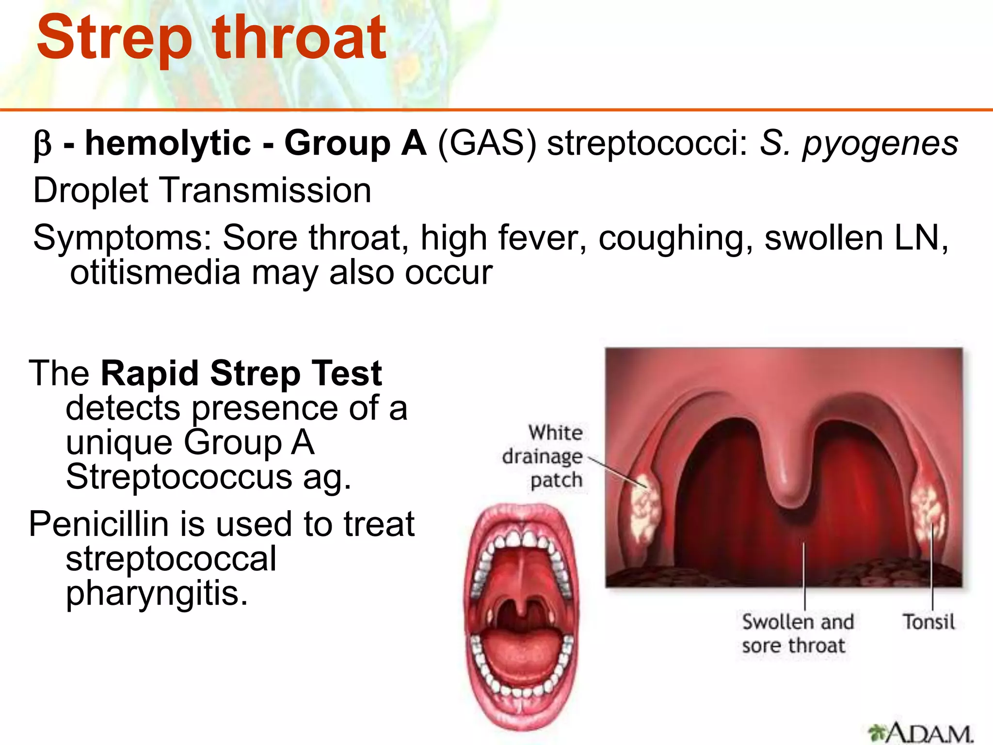 Bacterial infections of respiratory tract_.ppt