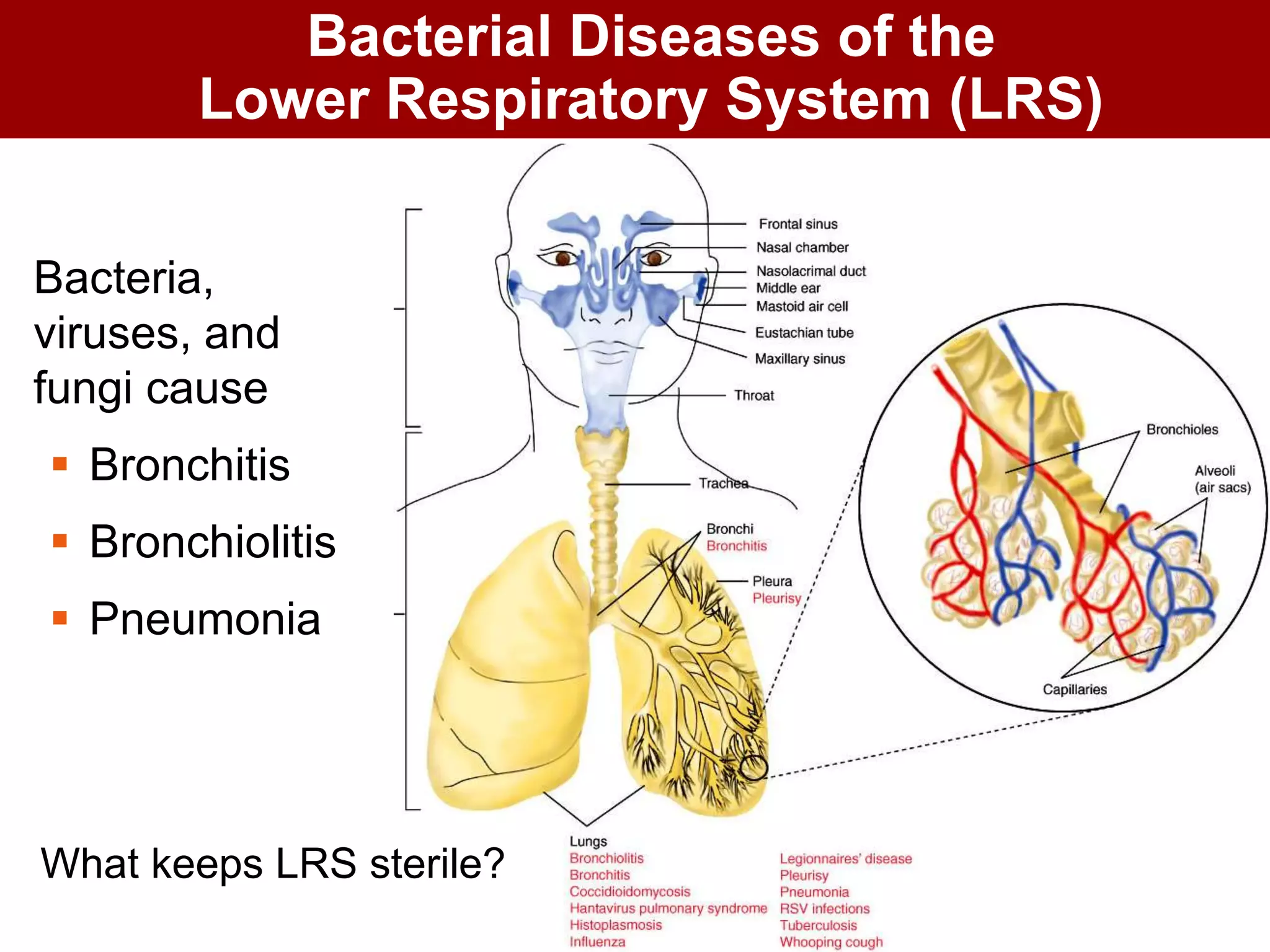 Bacterial infections of respiratory tract_.ppt