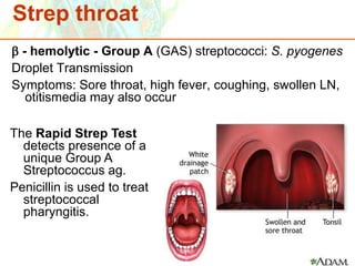 Bacterial infections of respiratory tract_.ppt