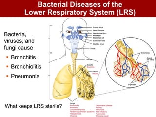 Bacterial infections of respiratory tract_.ppt