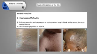 Bacterial infections of the skin.pptx