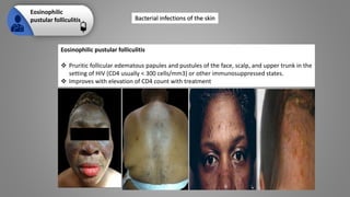 Bacterial infections of the skin.pptx