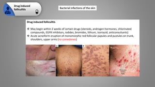 Bacterial infections of the skin.pptx