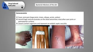 Bacterial infections of the skin.pptx