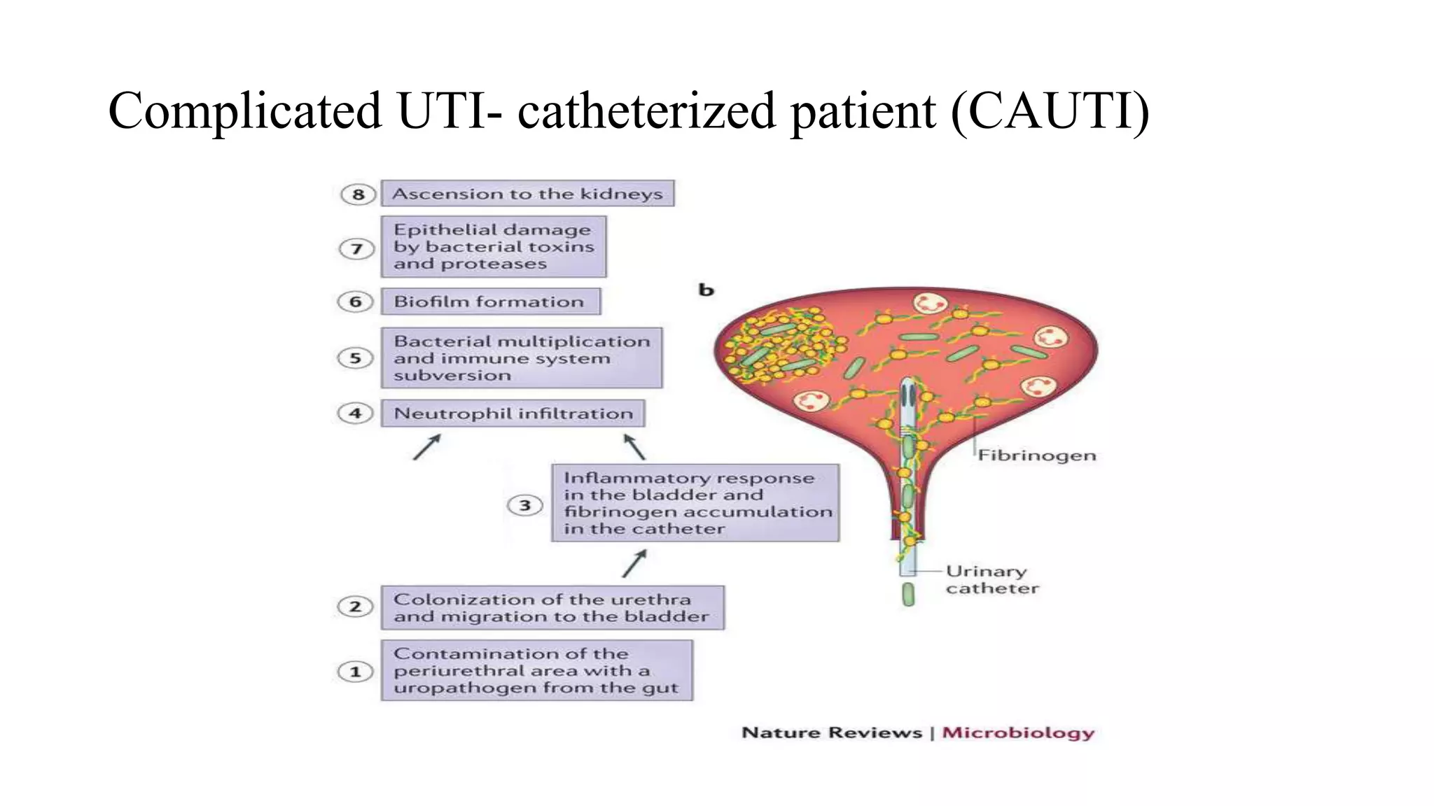 Bacterial infections of the urinary tract | PPTX