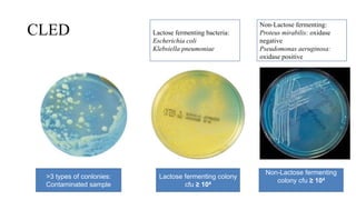 Bacterial infections of the urinary tract | PPTX