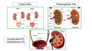 Bacterial infections of the urinary tract | PPTX