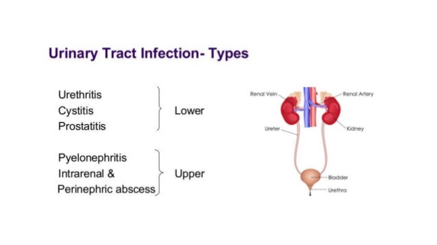 Bacterial infections of the urinary tract