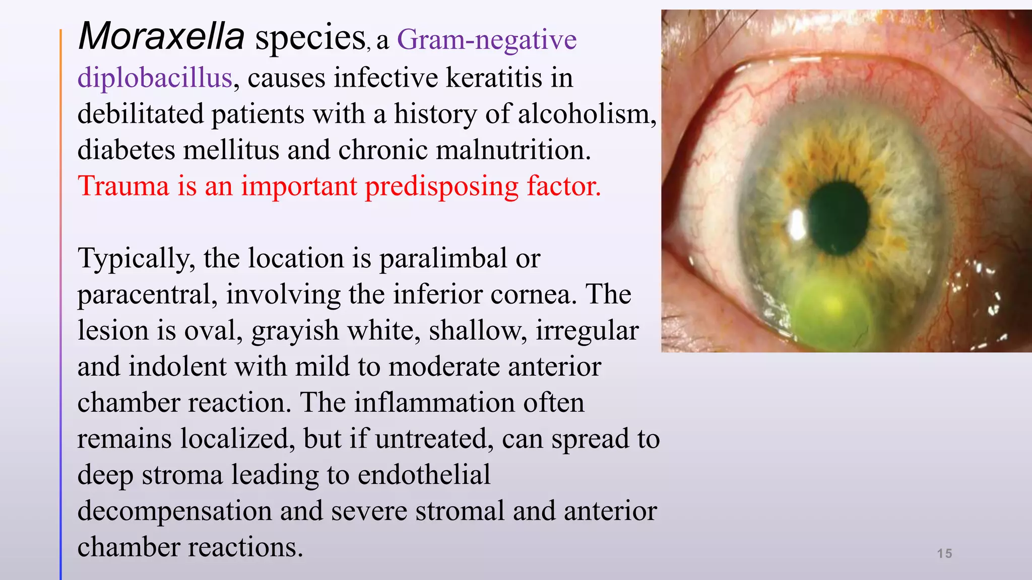 Bacterial keratitis | PPTX