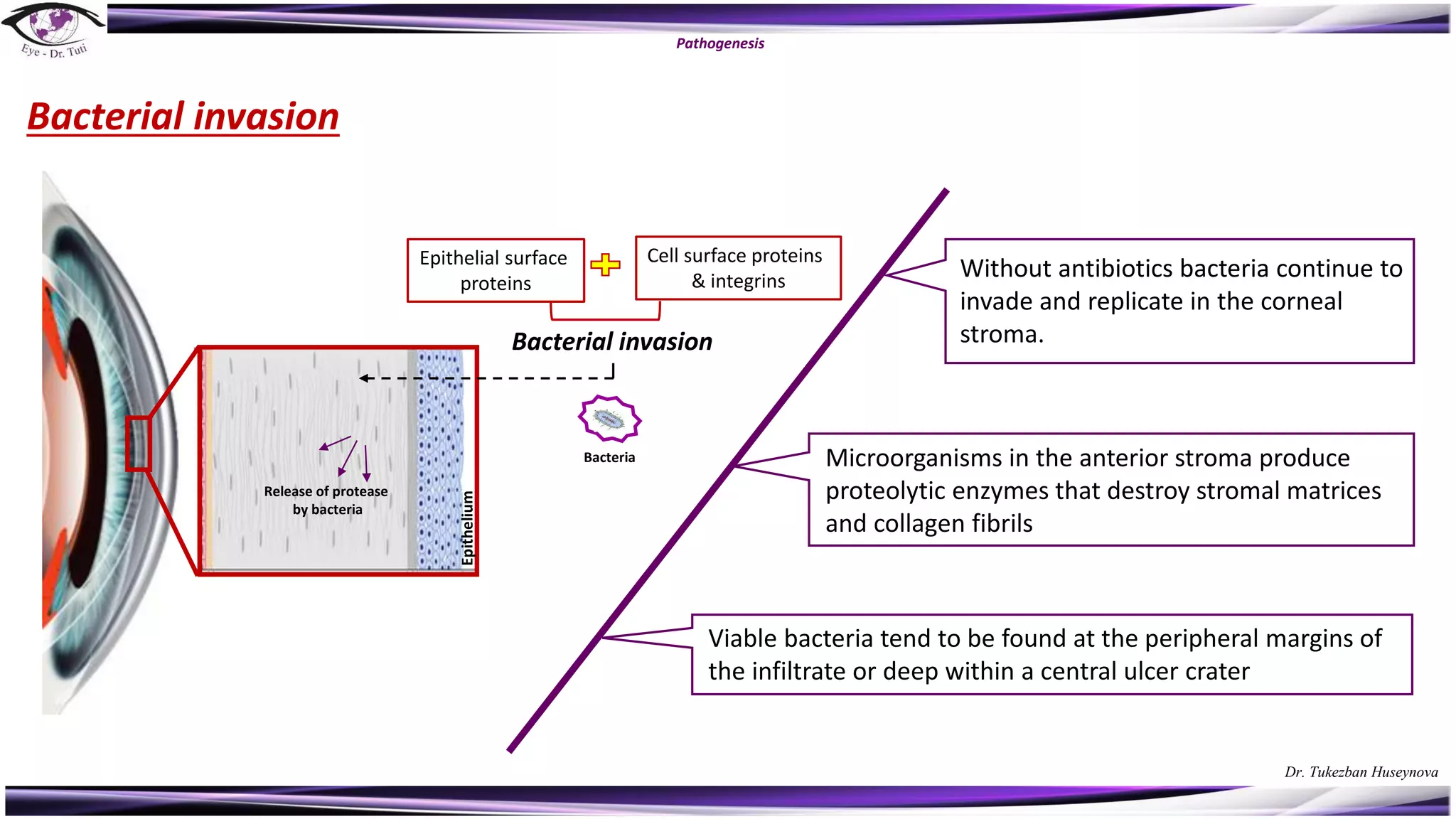 Bacterial keratitis | PDF