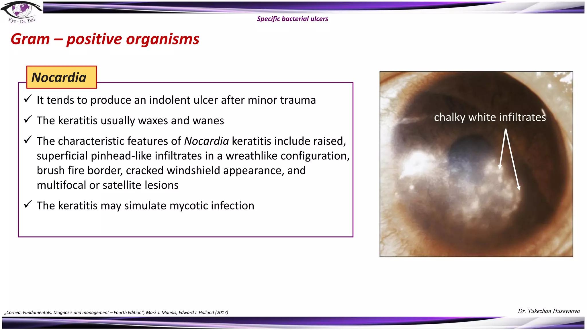 Bacterial keratitis | PDF