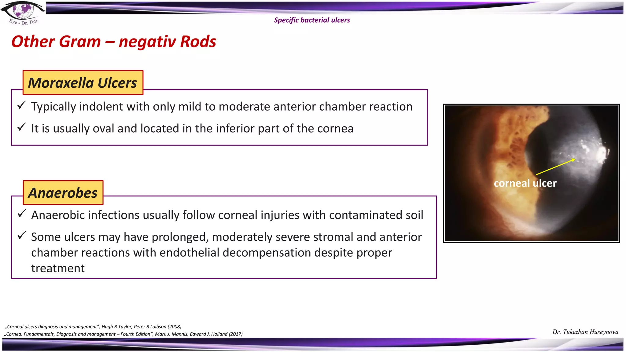 Bacterial keratitis | PDF