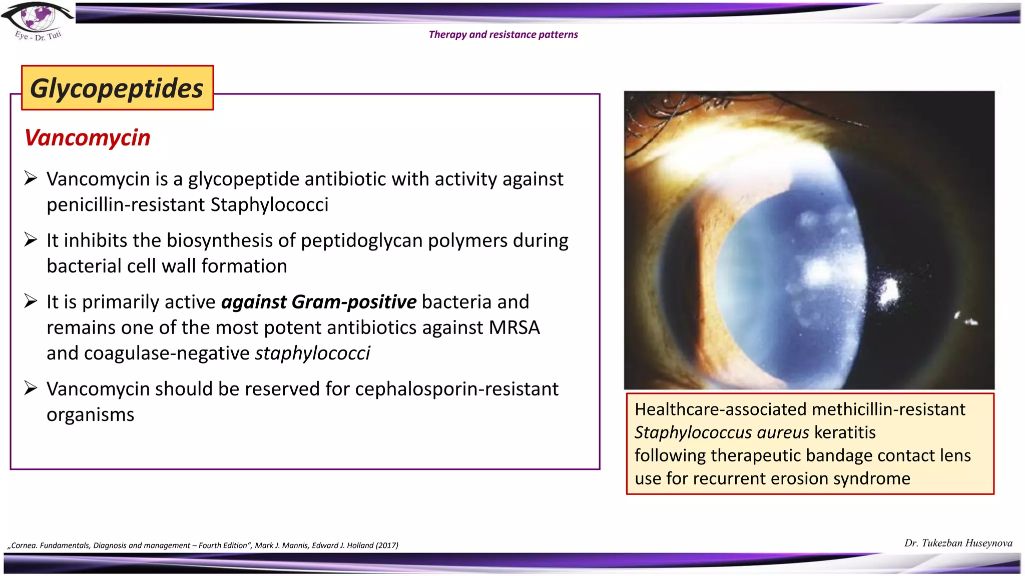 Bacterial keratitis | PDF