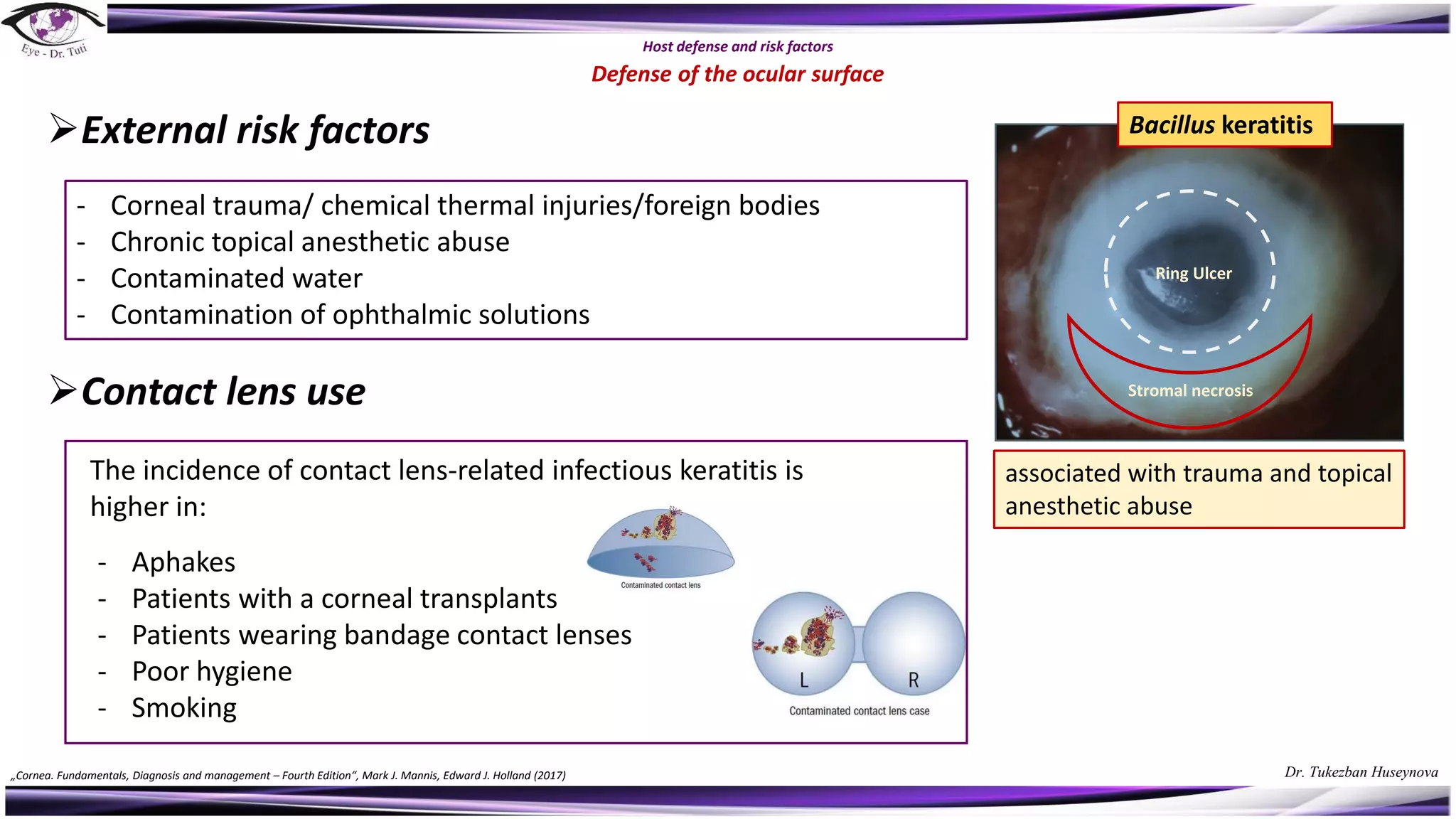 Bacterial keratitis | PDF