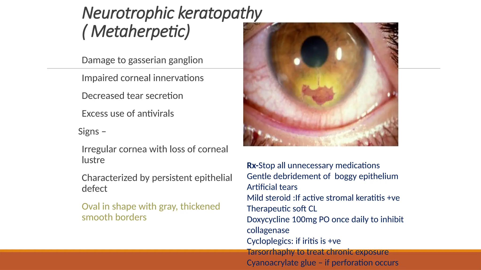 a presentation on infective bacterial keratitis.pptx | Eye and Vision Conditions | Diseases and ...