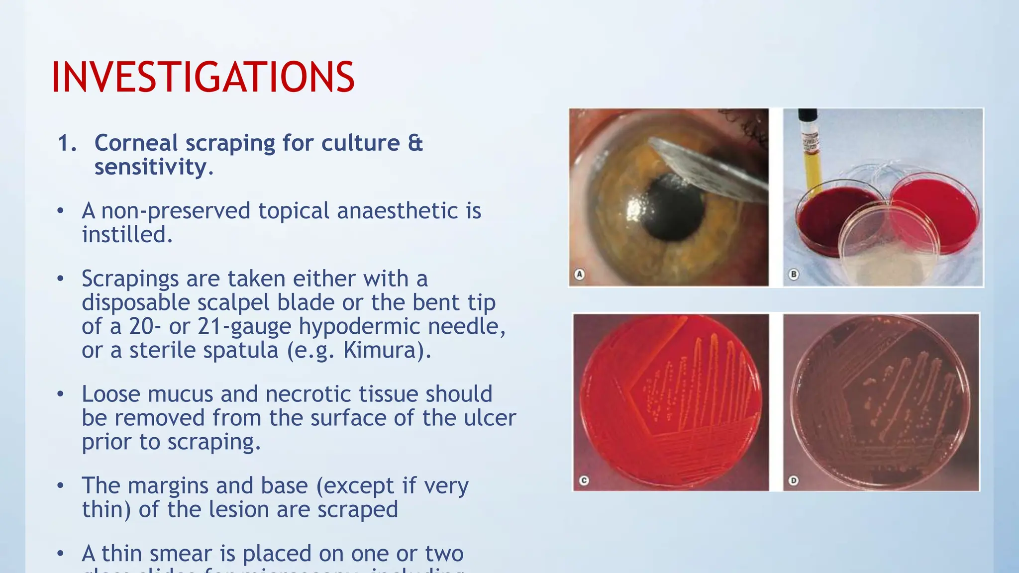 BACTERIAL KERATITIS POWERPOINT PRESENTATION | PPTX