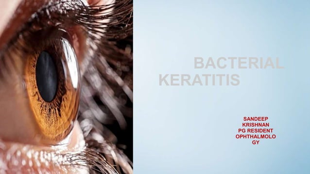 BACTERIAL KERATITIS POWERPOINT PRESENTATION | PPTX