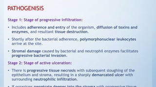 BACTERIAL KERATITIS POWERPOINT PRESENTATION | PPTX