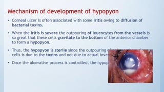 BACTERIAL KERATITIS POWERPOINT PRESENTATION | PPTX