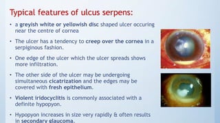 BACTERIAL KERATITIS POWERPOINT PRESENTATION | PPTX