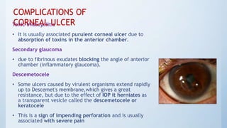 BACTERIAL KERATITIS POWERPOINT PRESENTATION | PPTX