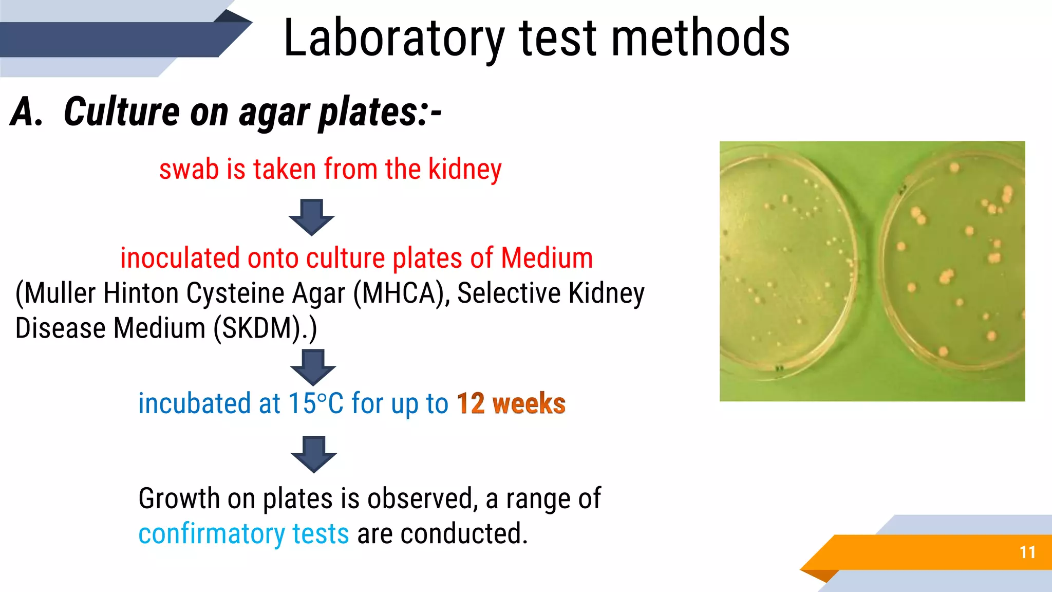 Bacterial Kidney Disease.pptx