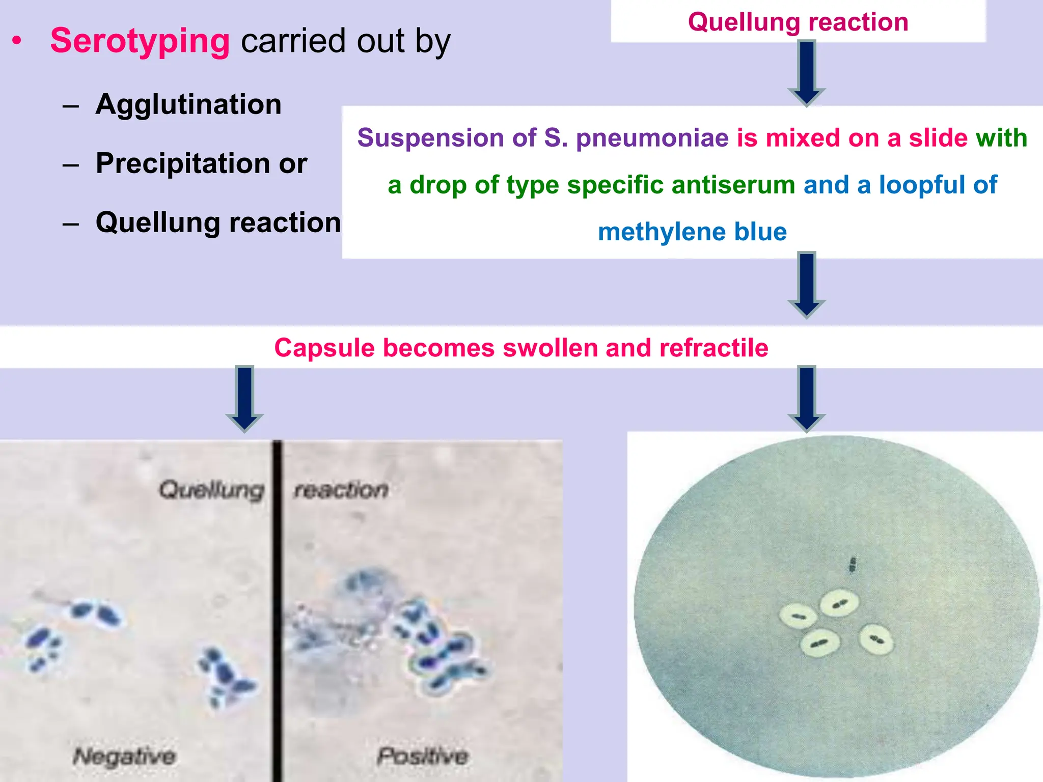 Bacterial Lobar Pneumoniae by Dr. Rakesh Prasad Sah.ppt