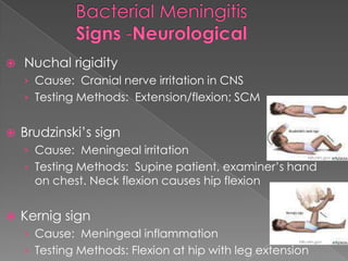 Nuchal Rigidity Meningitis