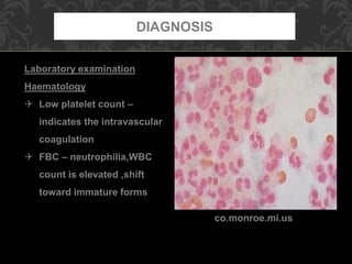 Bacterial meningitis | PPTX