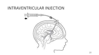 BACTERIAL MENINGITIS presentation slides | PPTX