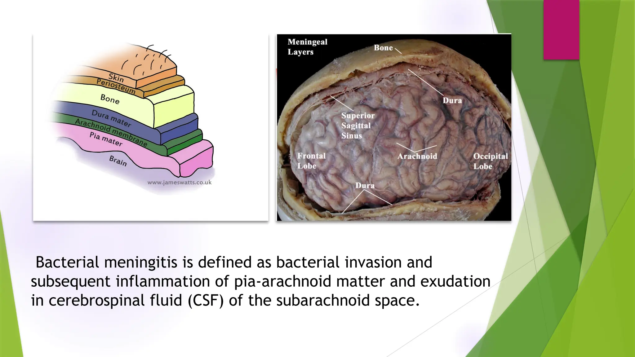 bacterial Meningitis meningitis meningitis.pptx