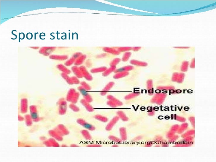 Spore stain - fajery