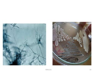 Bacterial morphology gliding and fruiting bacteria | PPTX