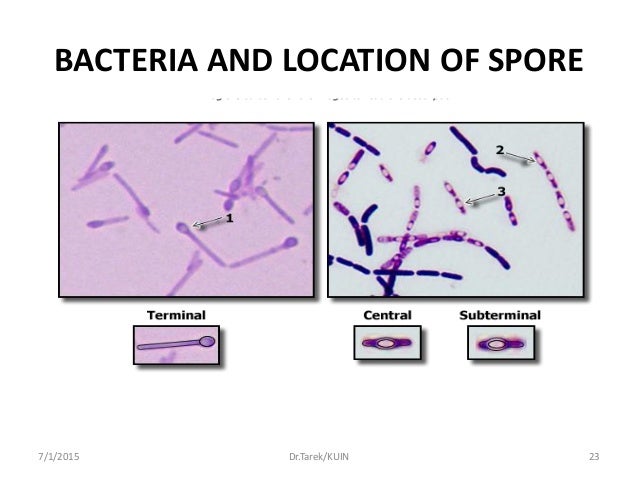 Bacterial morphology i