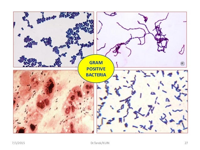 Bacterial morphology I