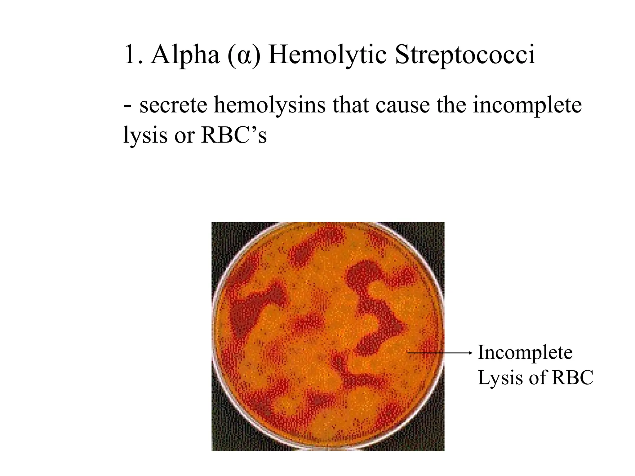Bacterial Phathogenesis and associated notes .ppt