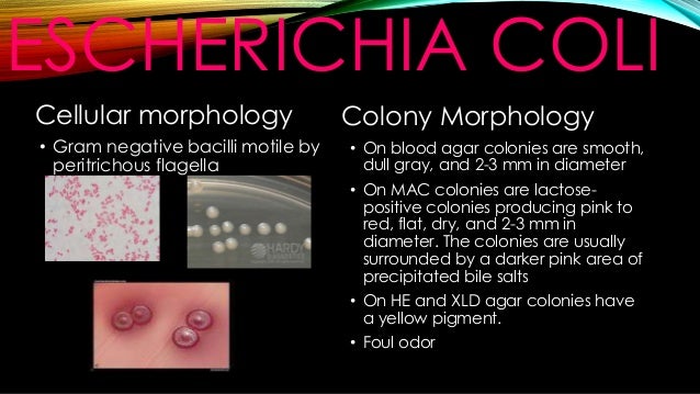 Escherichia Coli Colony Morphology