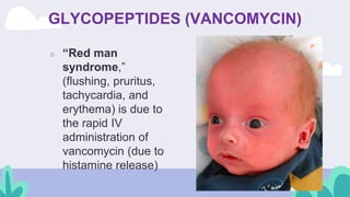 BACTERIAL SEPSIS AT THE PEDATRIC INTENSIVE CARE UNIT | PPT