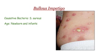 Bacterial Skin Disorders.pptx