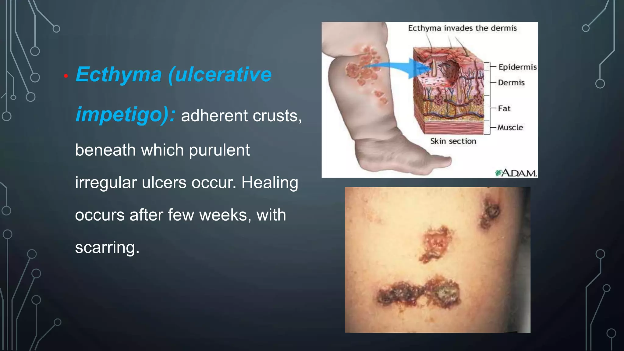 Bacterial skin infection- dermatology | PPTX