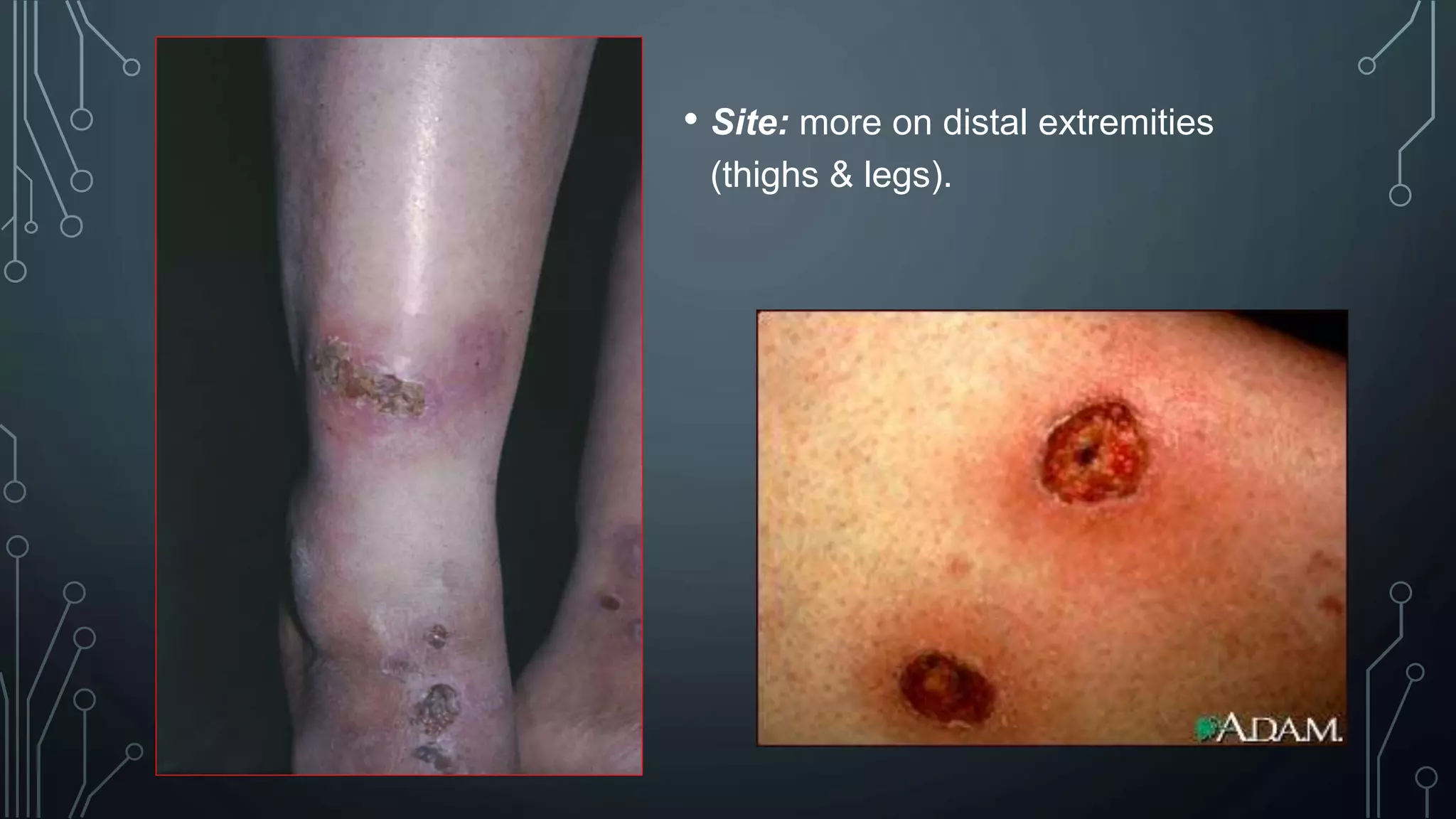 Bacterial skin infection- dermatology | PPTX