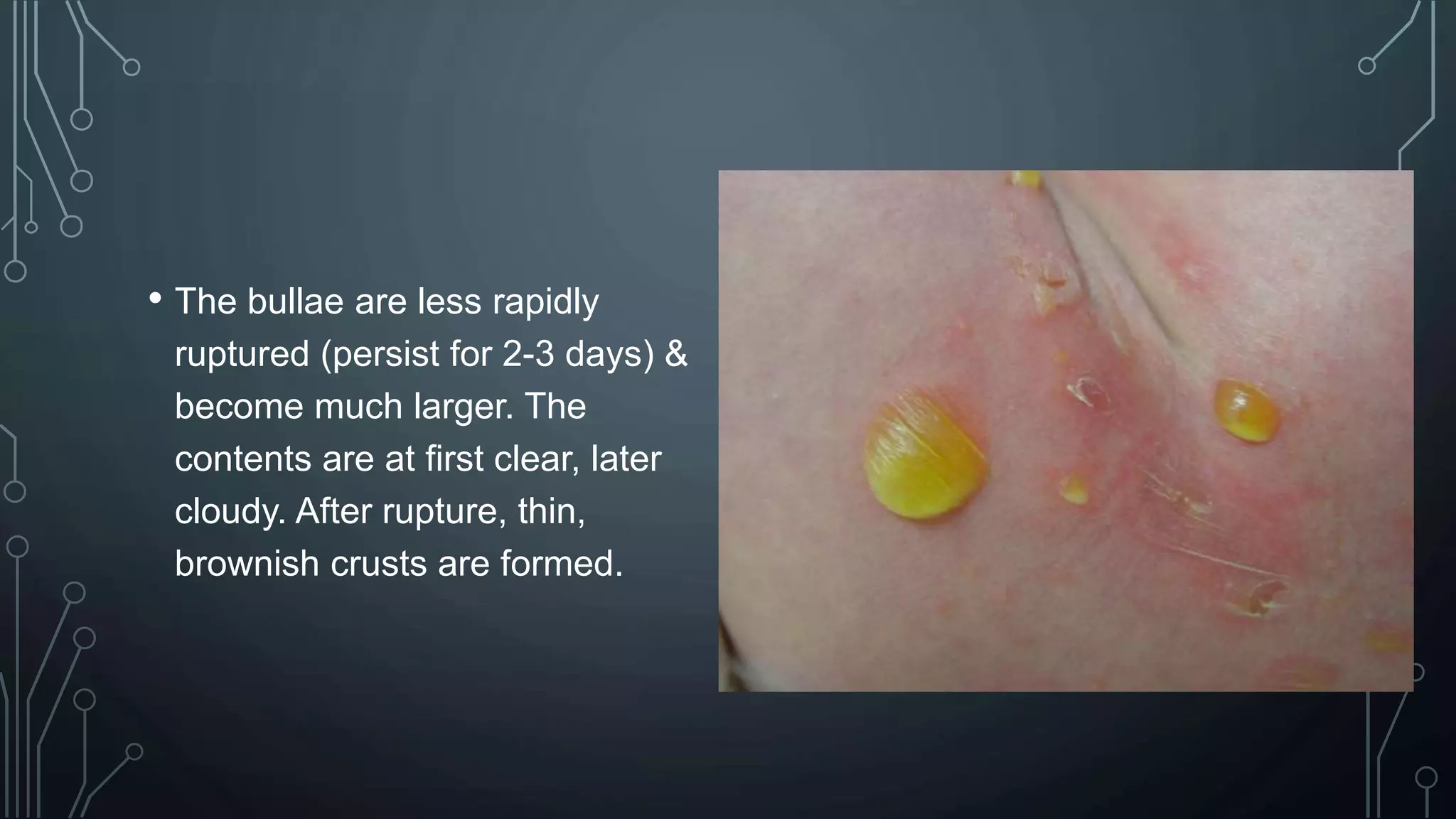 Bacterial skin infection- dermatology | PPTX
