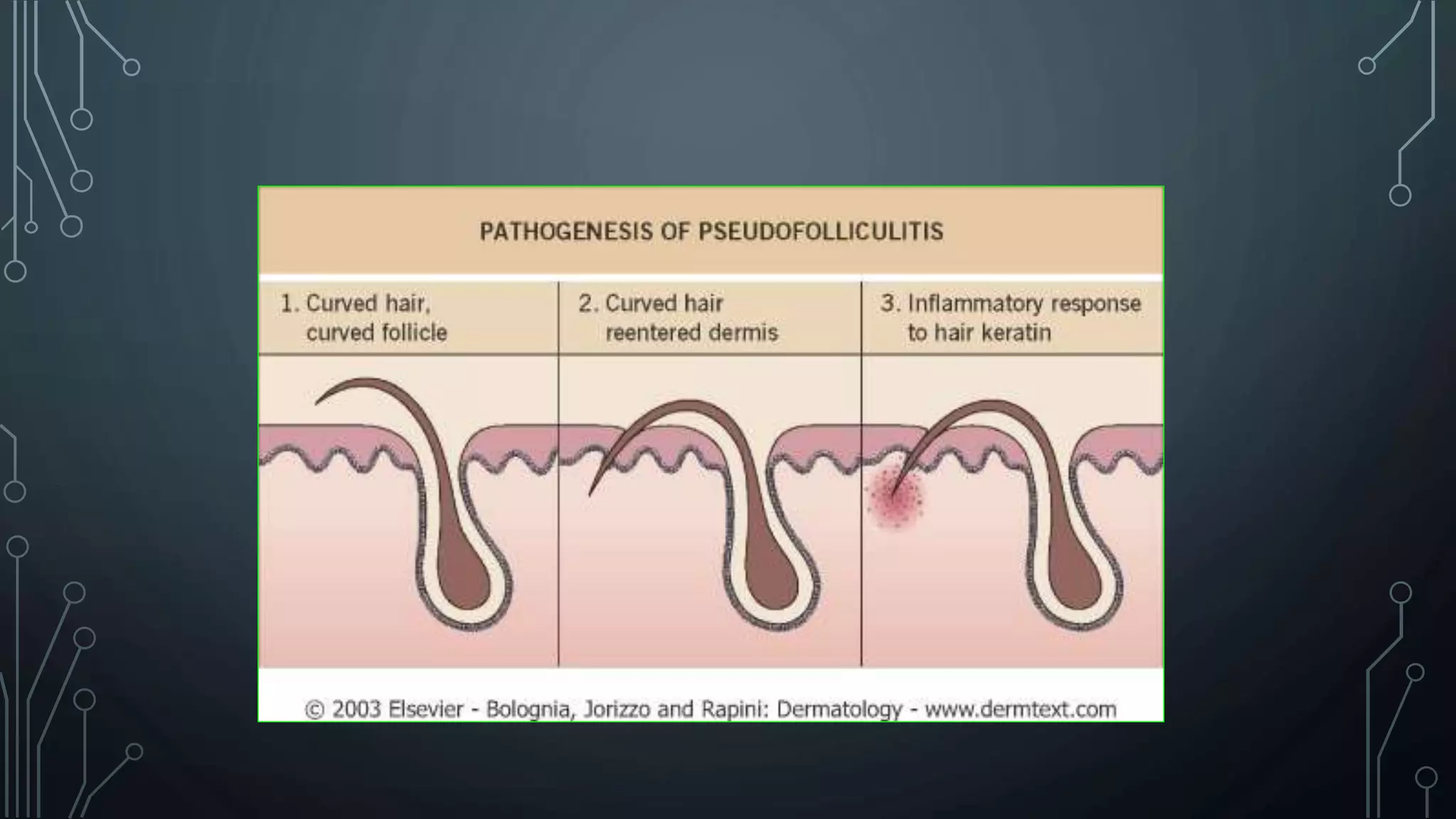 Bacterial skin infection- dermatology | PPTX