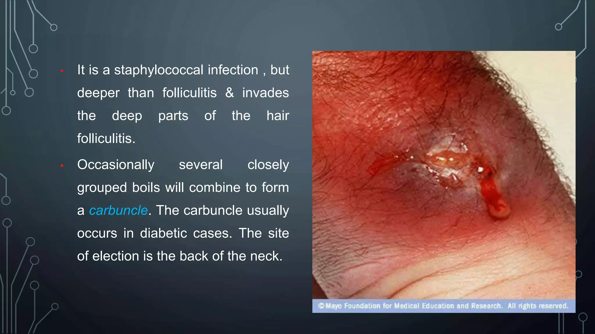Bacterial skin infection- dermatology | PPTX