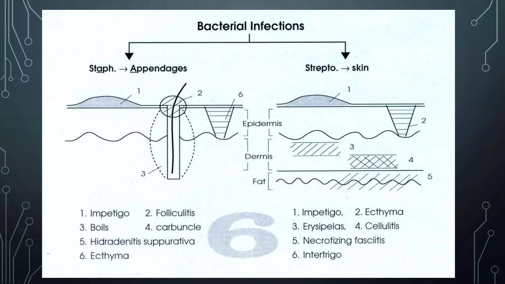 Bacterial skin infection- dermatology | PPTX