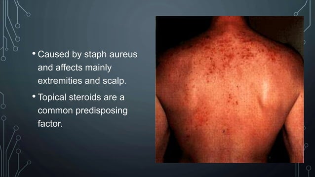 Bacterial skin infection- dermatology | PPTX