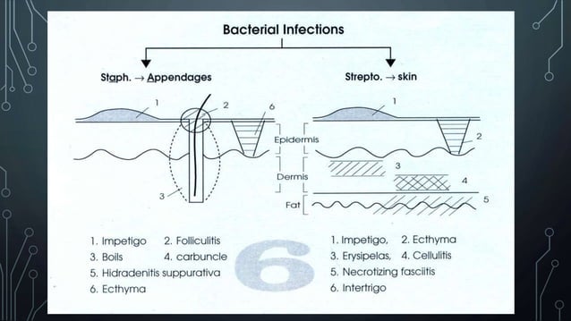 Bacterial skin infection- dermatology | PPTX