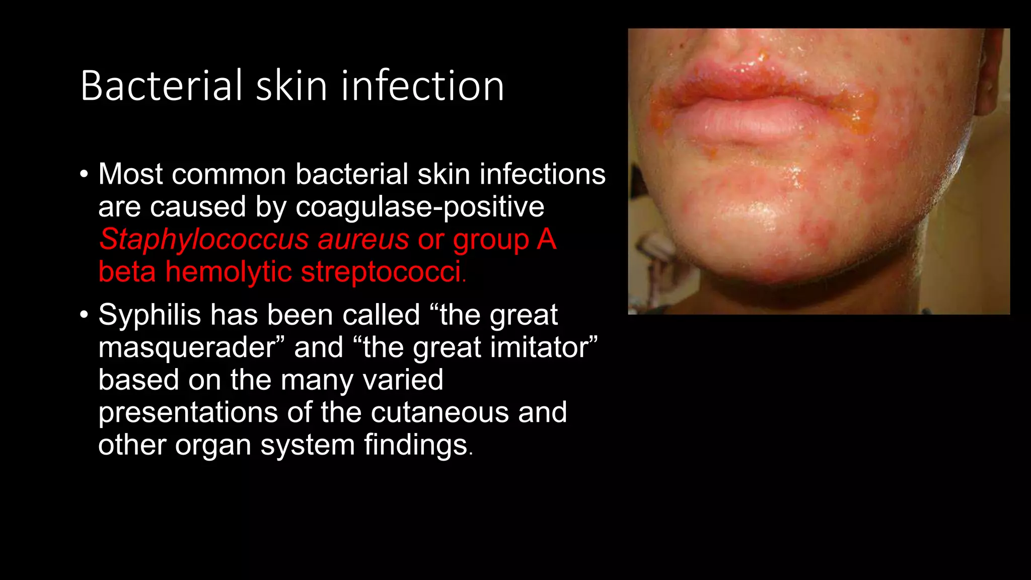 BACTERIAL SKIN INFECTION.pptx